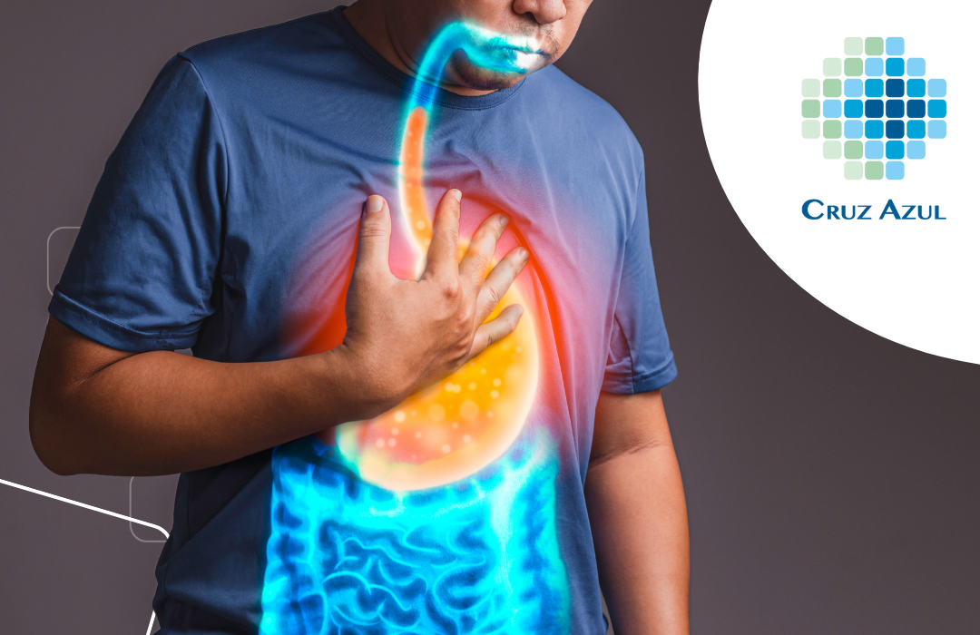 Refluxo Gastroesofágico - Hospital Cruz Azul | Ontem e hoje, cuidando ...